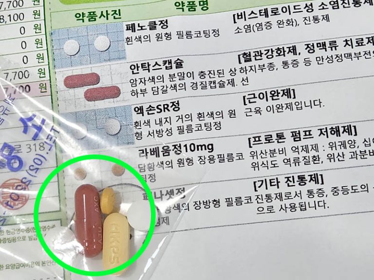 만성정맥부전 근막통증증후군 통증 안탁스캡슐 효능 및 부작용